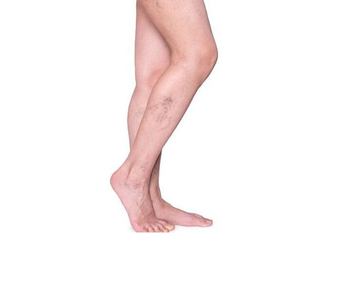 relief from hidden signs of poor leg circulation.